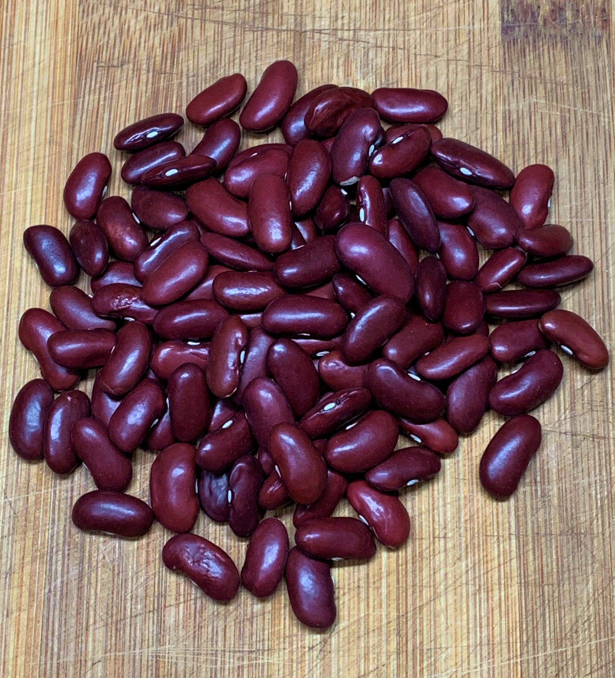 Red Kidney Beans Yummy Nuts Bulk Foods Red Kidney Beans Yummy Nuts Bulk Foods